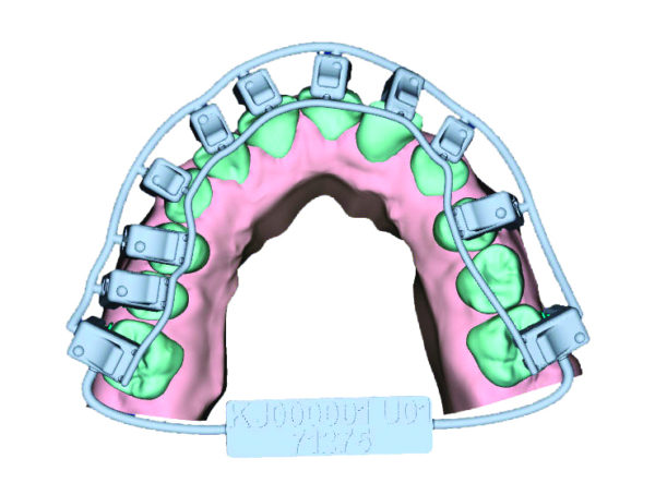 Orthodontic News - suresmile 7.2…More Powerful Than Ever