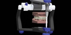 Digital Positioners Orthodontic Practice US