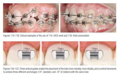 Maintaining clearly defined treatment objectives: part 2 Orthodontic ...