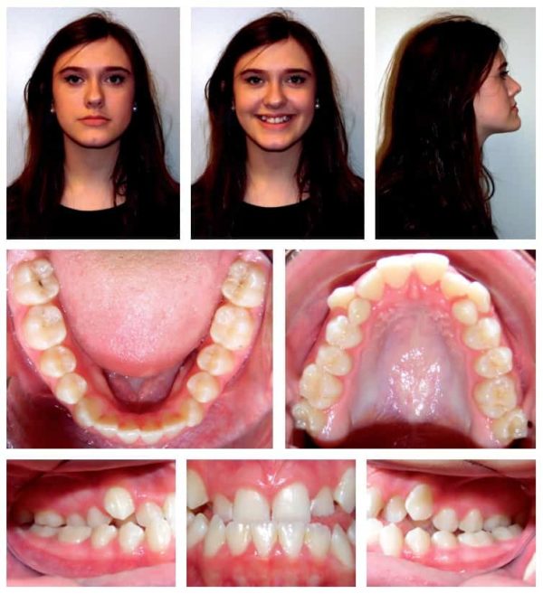 Treatment plan avoiding surgery offers advantage