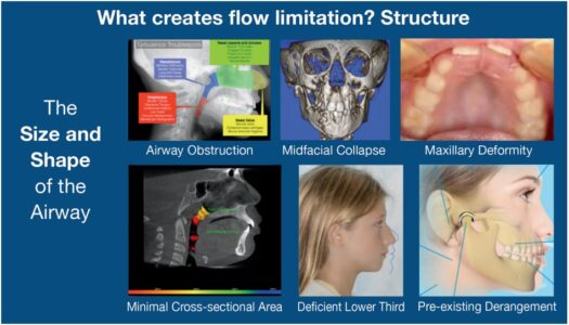 Airway Treatment In Orthodontics — Avoiding Chronic Threats to Breathing