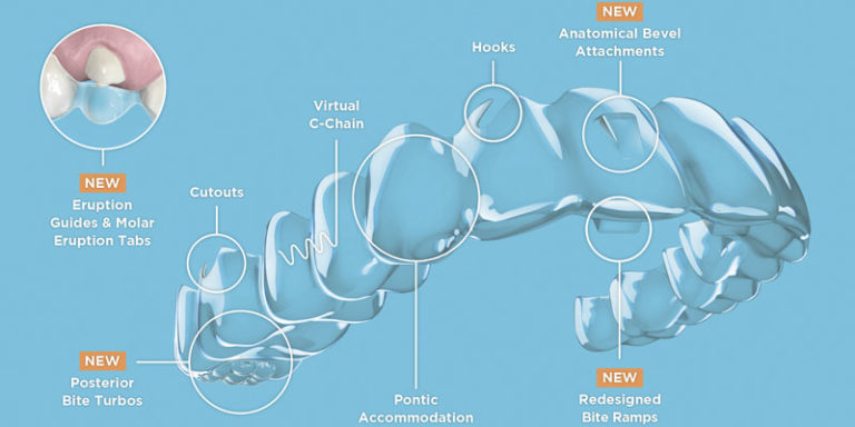 Spark Aligners for more control and flexibility