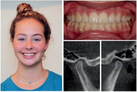 Diagnostics improved with CBCT imaging