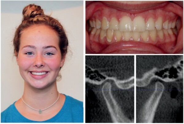 Diagnostics improved with CBCT imaging
