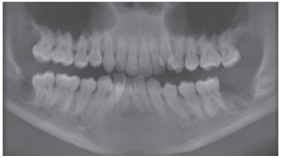 CBCT imaging — a view that affects treatment planning