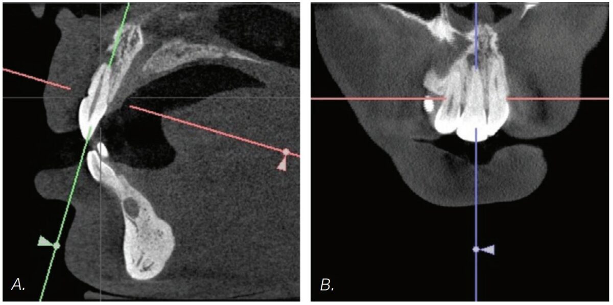 CBCT imaging — a view that affects treatment planning