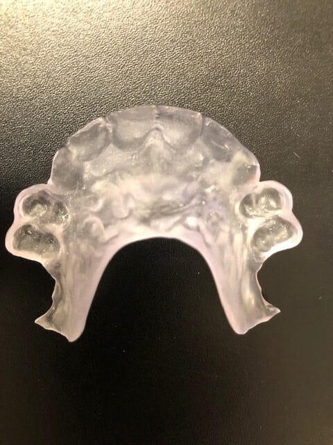 Orthodontic News - URBANEK TMJ DEVICE ANNOUNCES LAUNCH OF COMMERCIAL ...