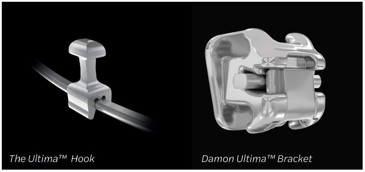 Ormco brings you Spark Clear Aligners and Damon Ultima as its latest ...