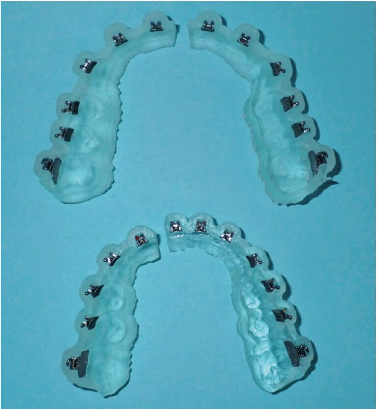 Benefits of 3D printing to orthodontists