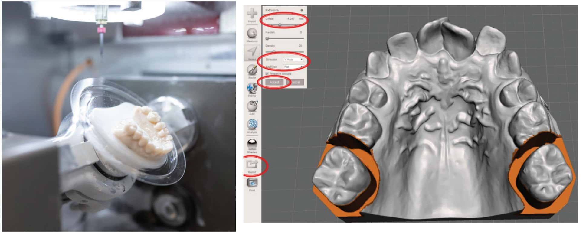 Benefits of 3D printing to orthodontists