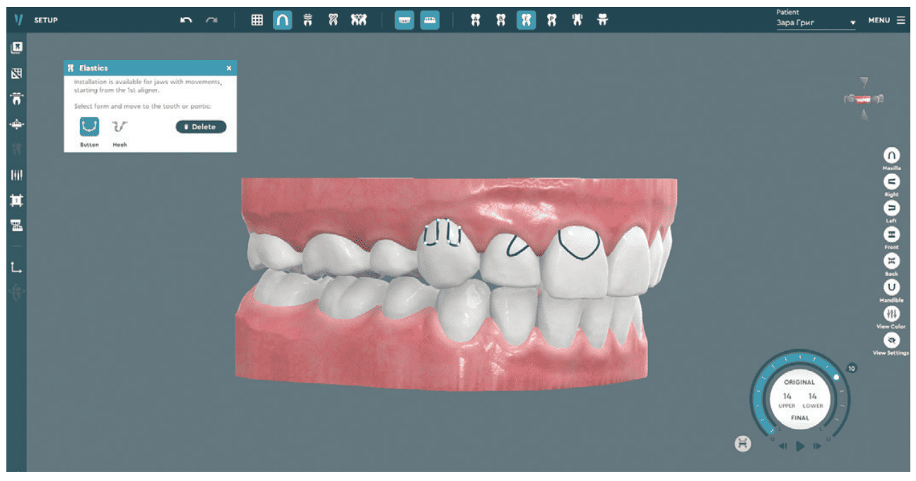 Incorporating Artificial intelligence — for more accurate orthodontic ...