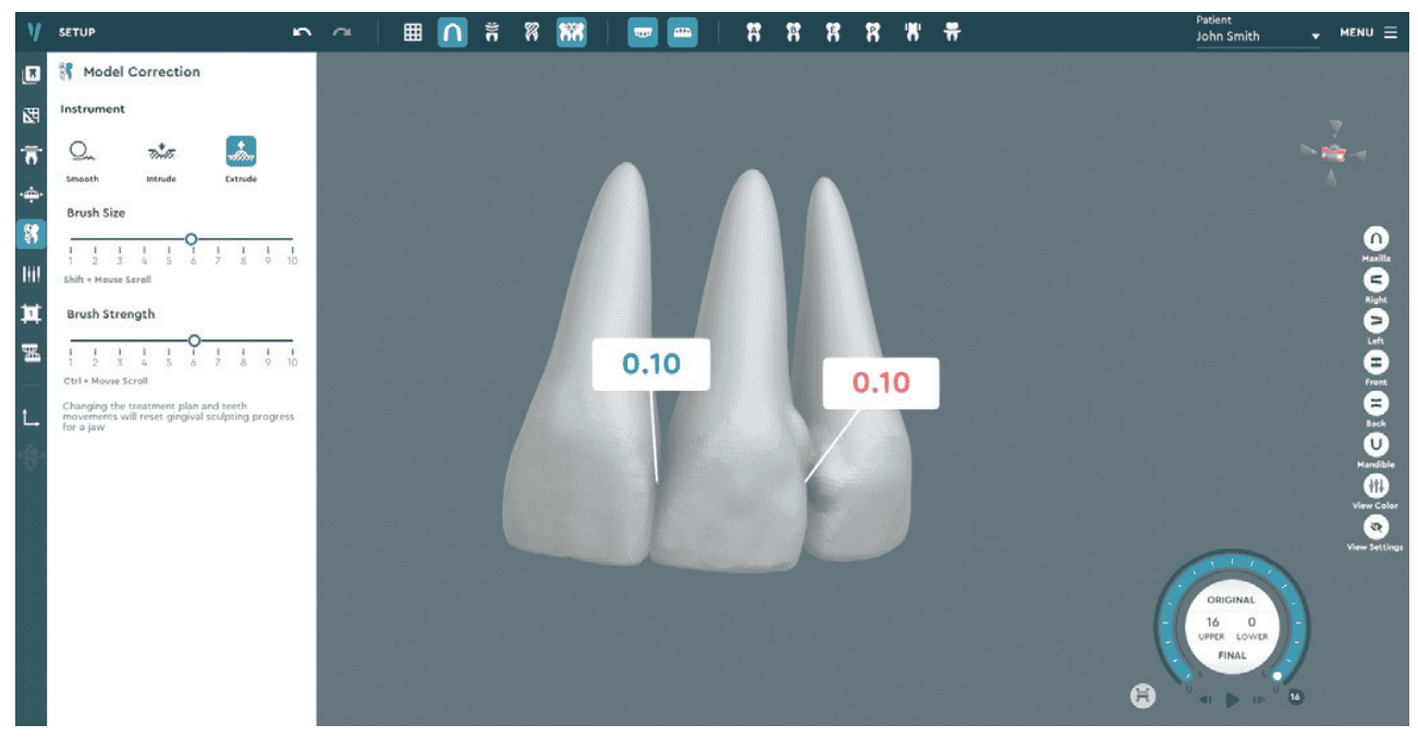 Incorporating Artificial intelligence — for more accurate orthodontic ...