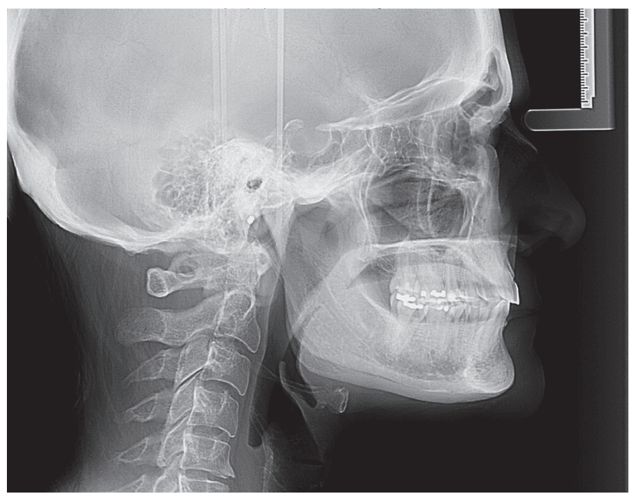 Ormco — providing innovative orthodontic solutions