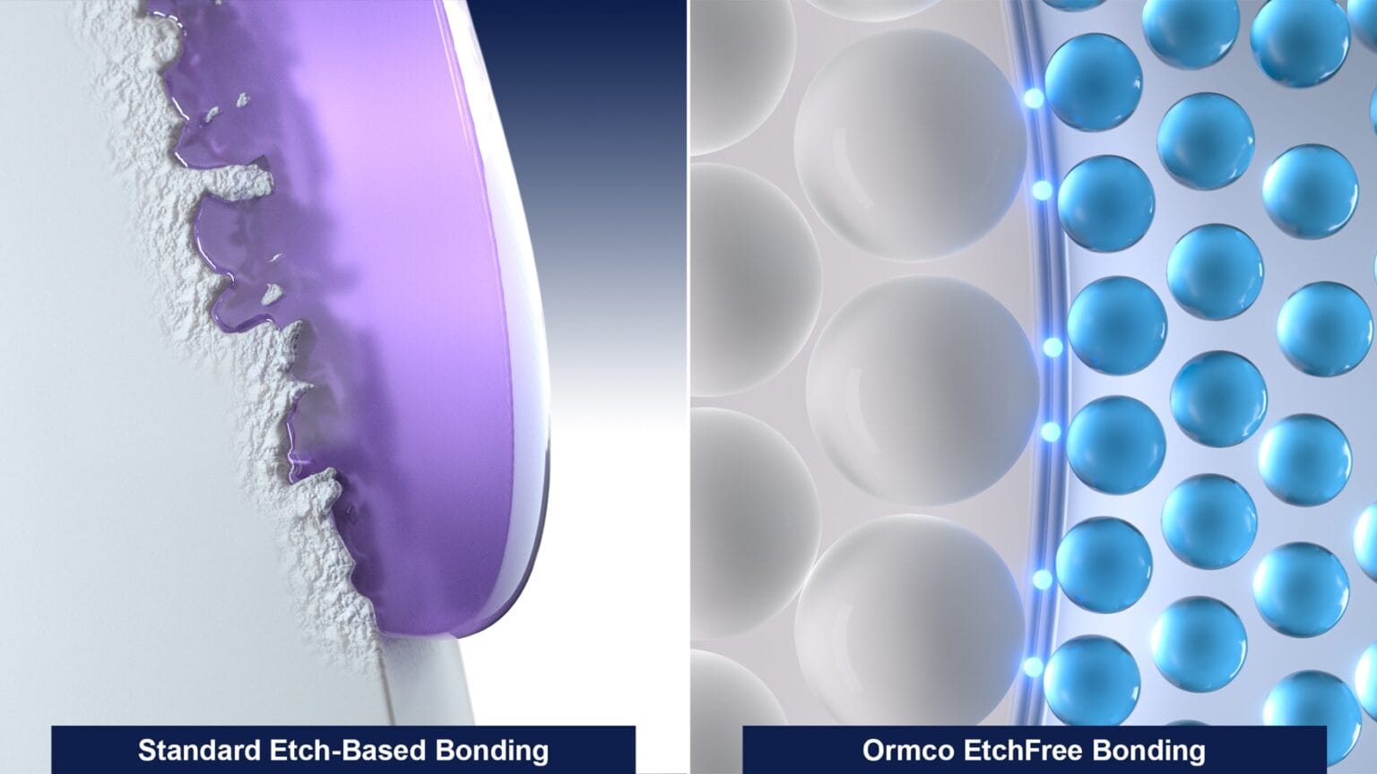 Orthodontic News - Game-Changing Adhesive System Revolutionizes the ...